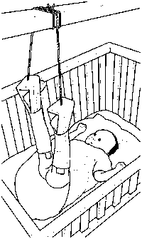 Gallow’s traction – Orthopaedics Plus